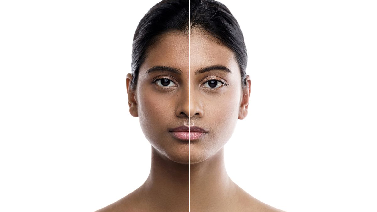 What Is The Colour Of Indian Skin